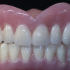 Gallery | Smile Prosthetics