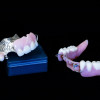 Gallery | Smile Prosthetics